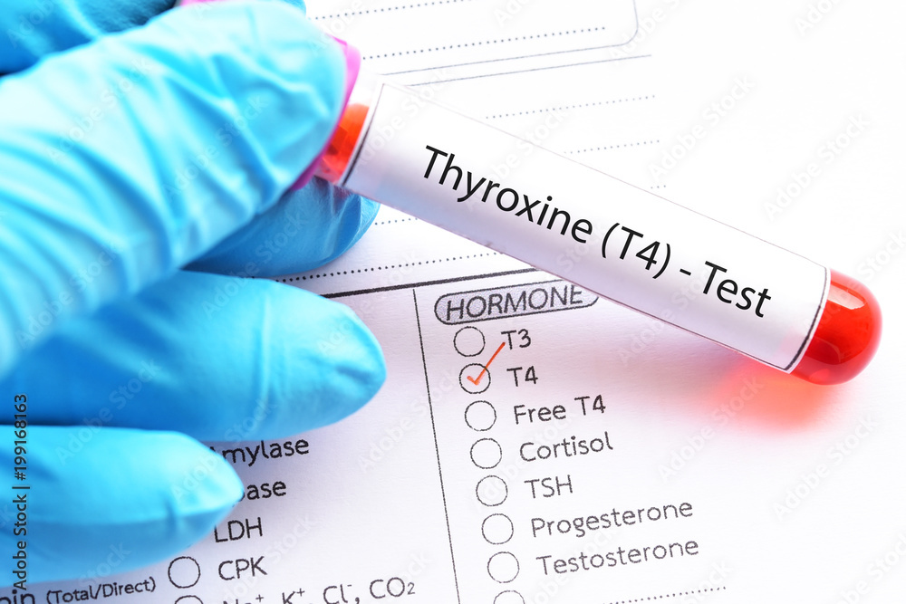 TOTAL THYROXINE T4 TOTAL THYROXINE T4